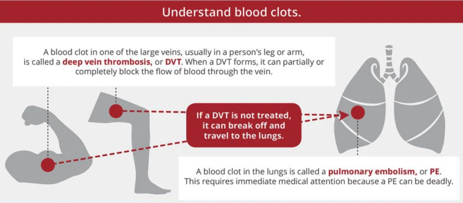 Intermittent Pneumatic Compression Devices | Recovery, DVT Prevention