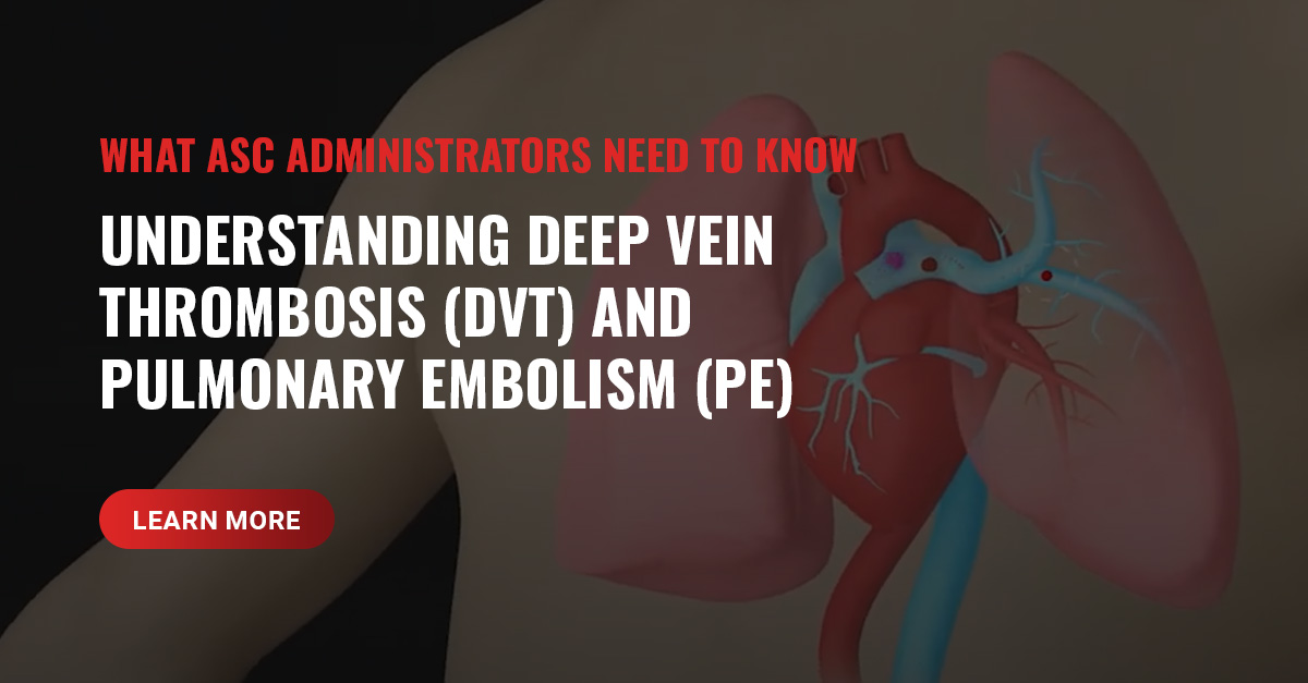 DVT PE Guide for ASC Administrators | DVT and Pulmonary Embolism